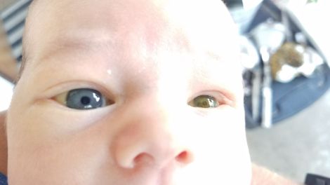 Discovering PHPV/PFV in our Newborn | For Little Eyes